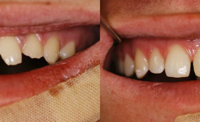 Treatments - Dr Hartshorne